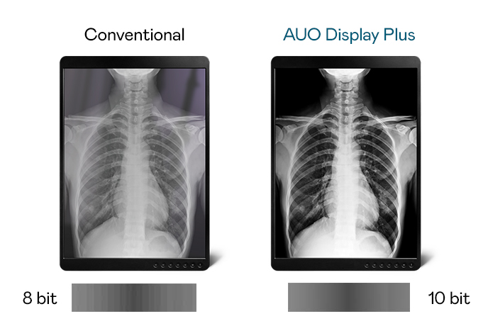 Medical-Grade Display | AUO Display Plus